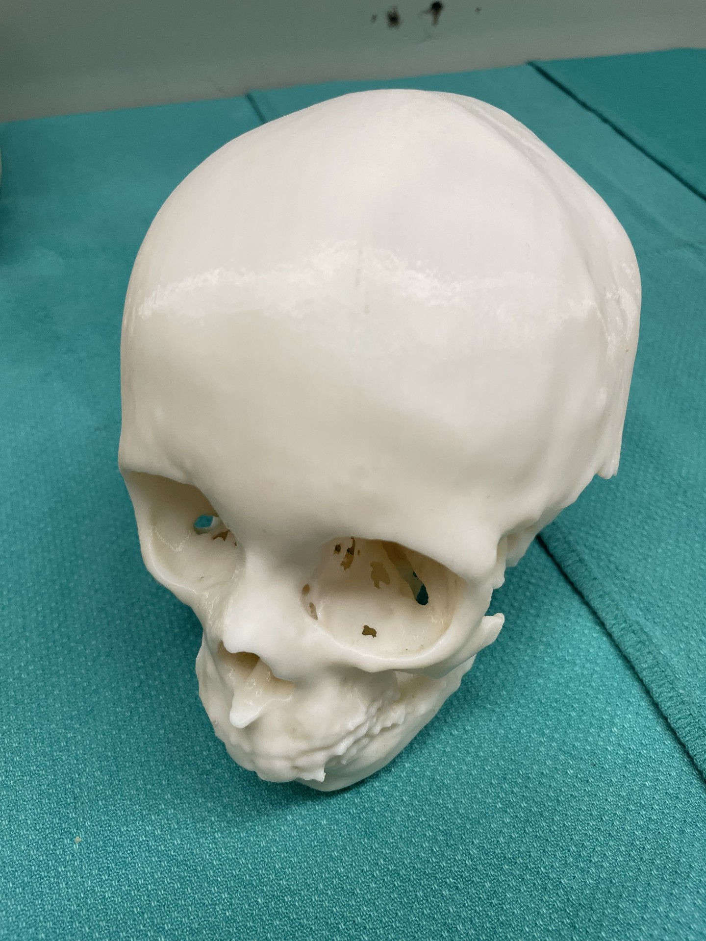 Surgical Robotics and 3D Printing – PCIGITI